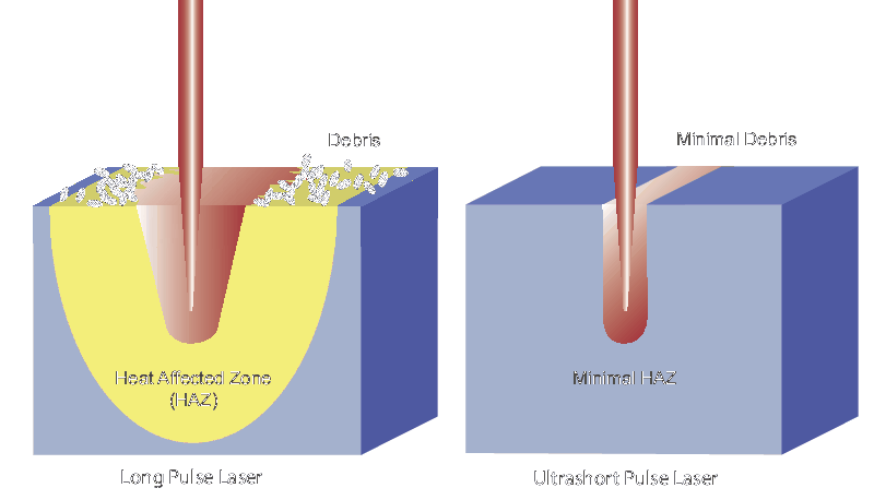 Laser Micromachining